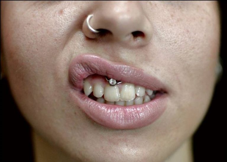 5 Reasons to Get a Smiley Piercing [with 75+ Pictures] - Wild Tattoo Art