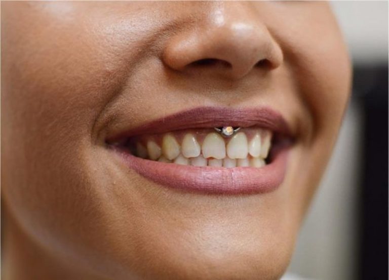 5 Reasons to Get a Smiley Piercing [with 75+ Pictures] - Wild Tattoo Art