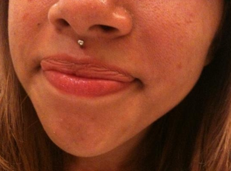 55 Different Types of Lip Piercing Ideas: (with Pain, Healing Time ...